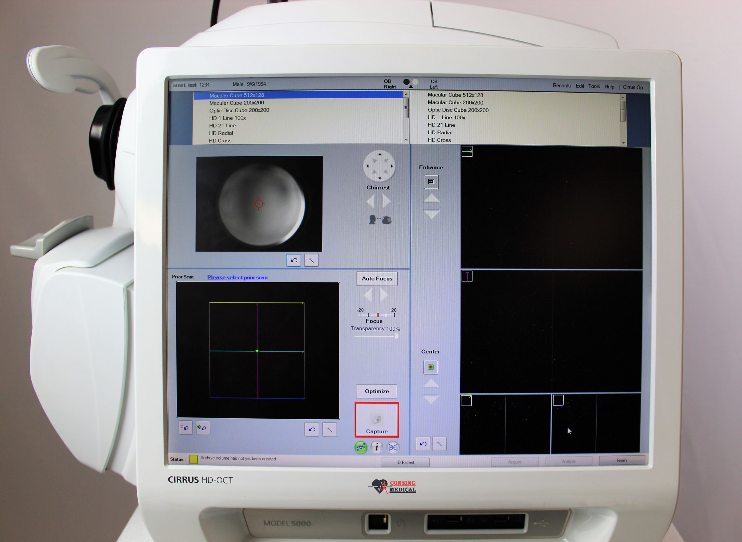 Zeiss Cirrus HD-OCT 5000 - Consing Medical
