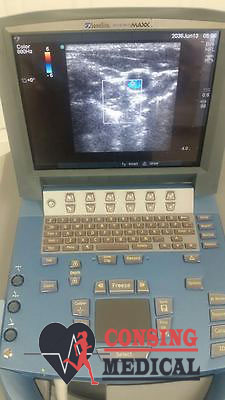 New SonoSite MicroMaxx Ultrasound - Consing Medical