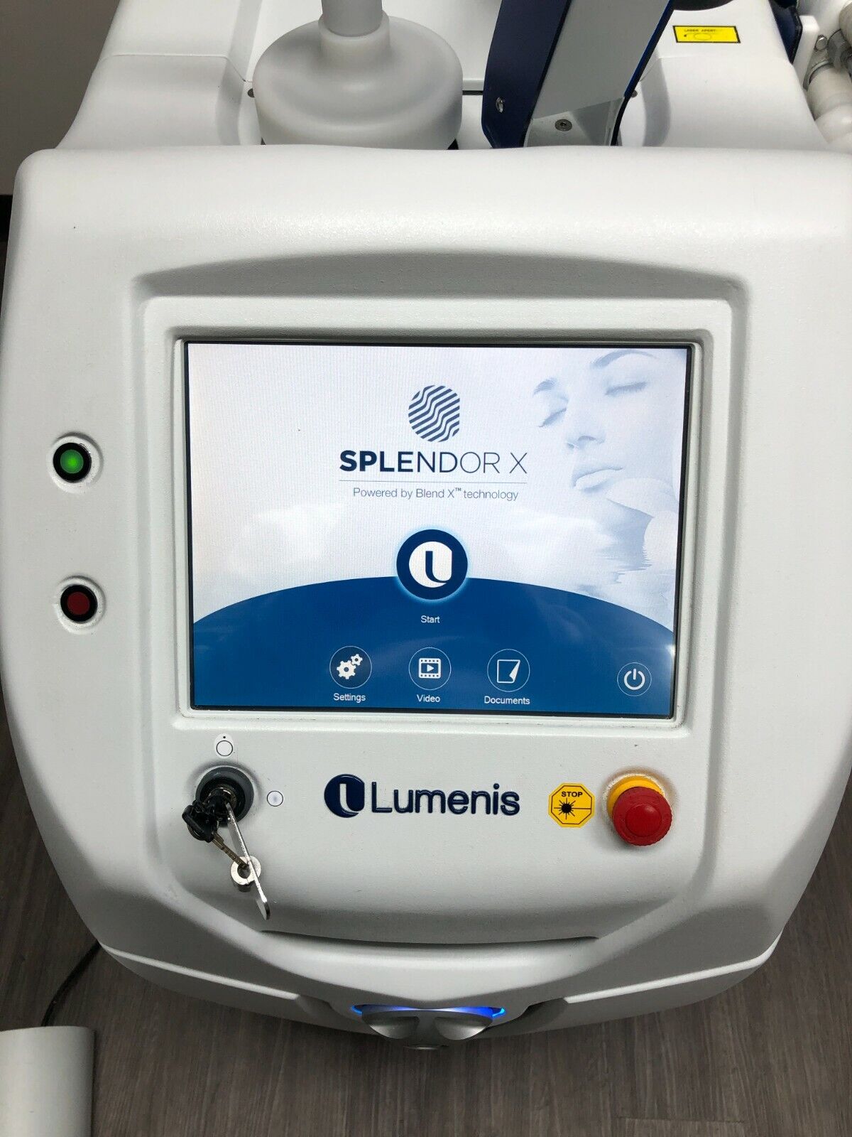 Sale - Lumenis Splendor X - Consing Medical